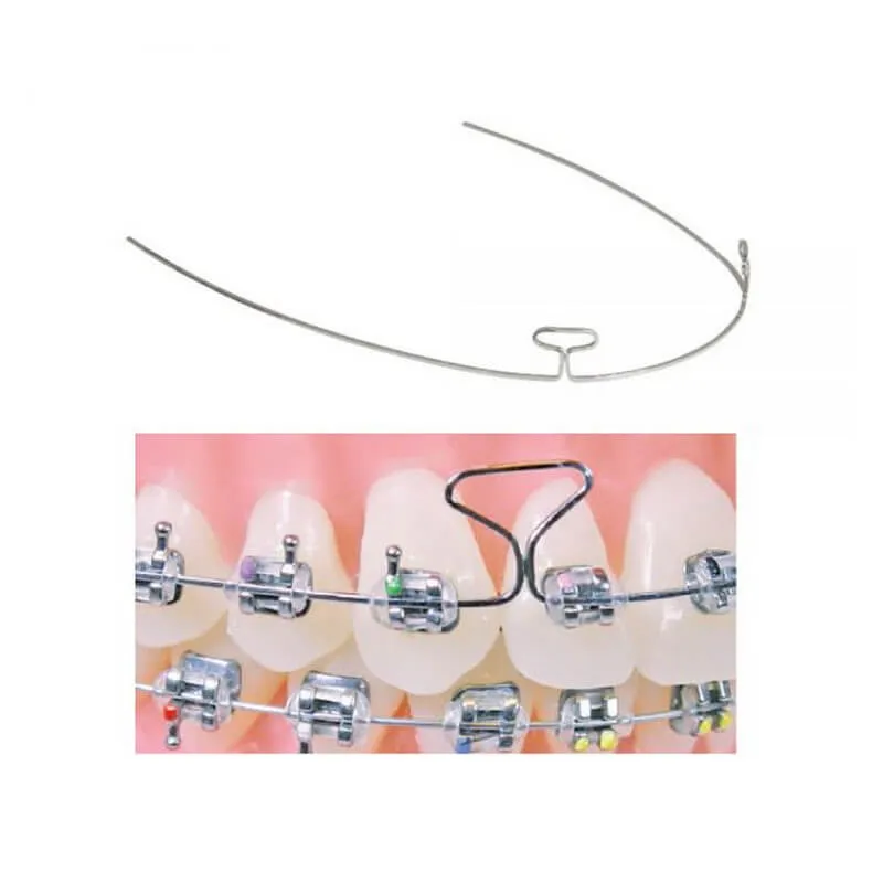 TruForce 2 Keyhole Wire, 017x025, Universal 26mm - SOUQ DENTAL